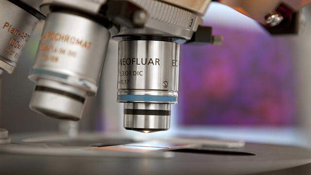 Deadly, drug-resistant fungus hits NC, recent data shows | Charlotte ...